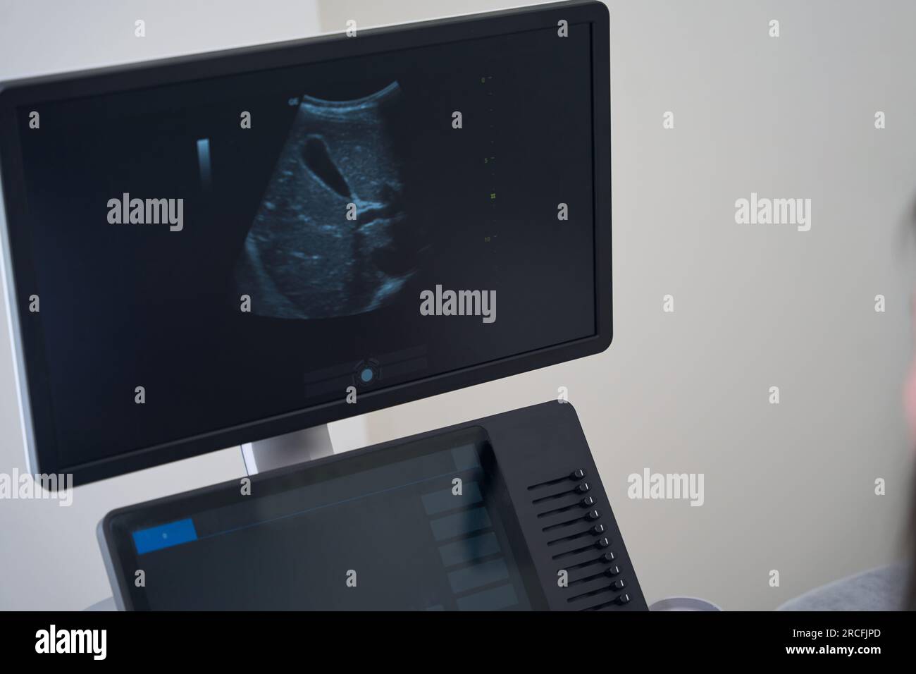 Monitor of ultrasound machine with the image of internal organs Stock ...