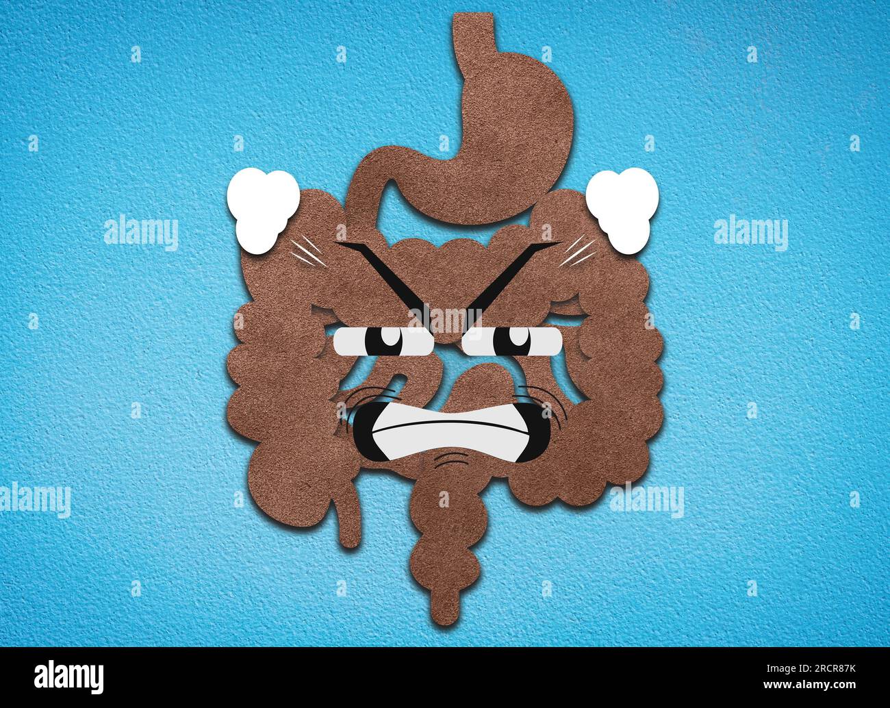 Irritable Bowel Syndrome Ibs Chronic Disorder Affecting The Large