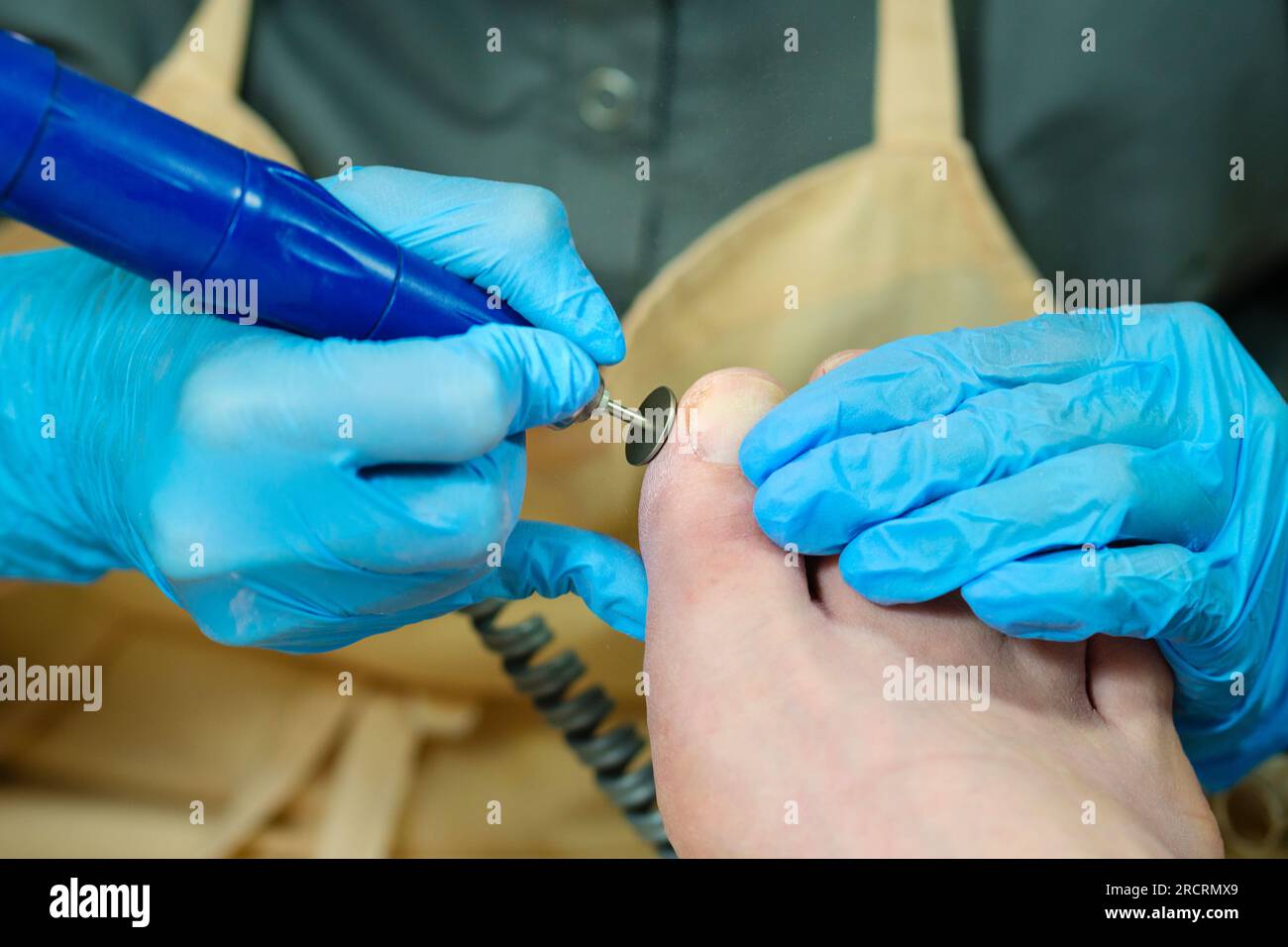 Toenail point hi-res stock photography and images - Alamy