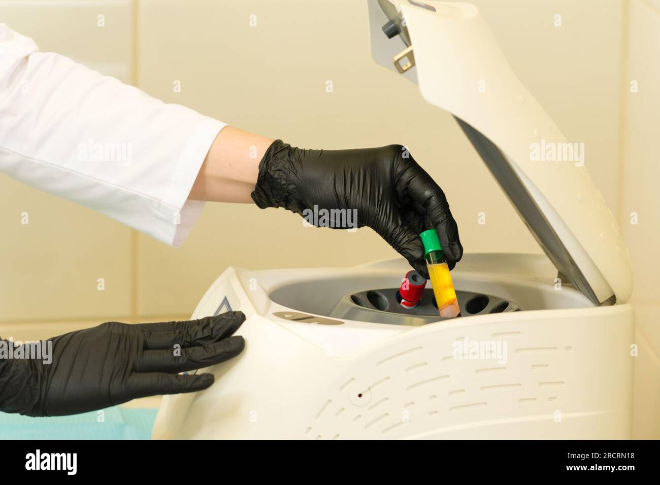 Test tube in doctor hand for PRP therapy with blood platelet rich ...