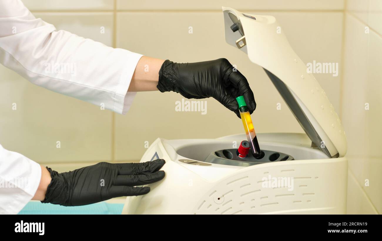 Medical tube in cosmetician hand for PRP therapy with blood platelet ...