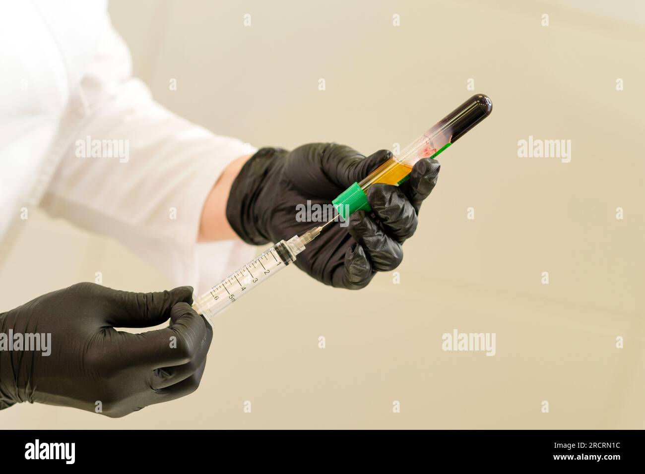 Syringe and test tube in cosmetologist hand for PRP therapy with blood ...