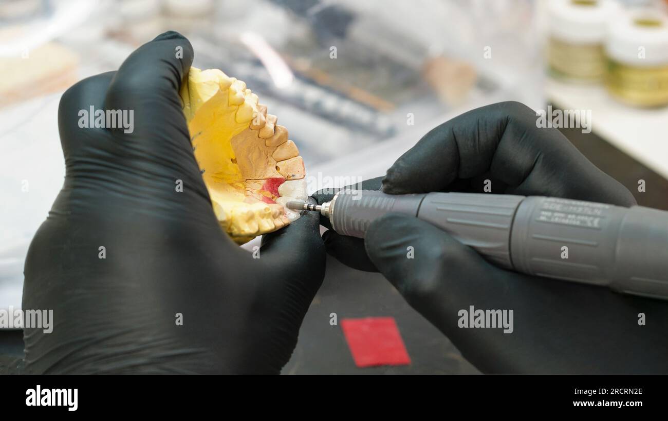 Manufacturing of dentures close up. Dental technician worker working on ...