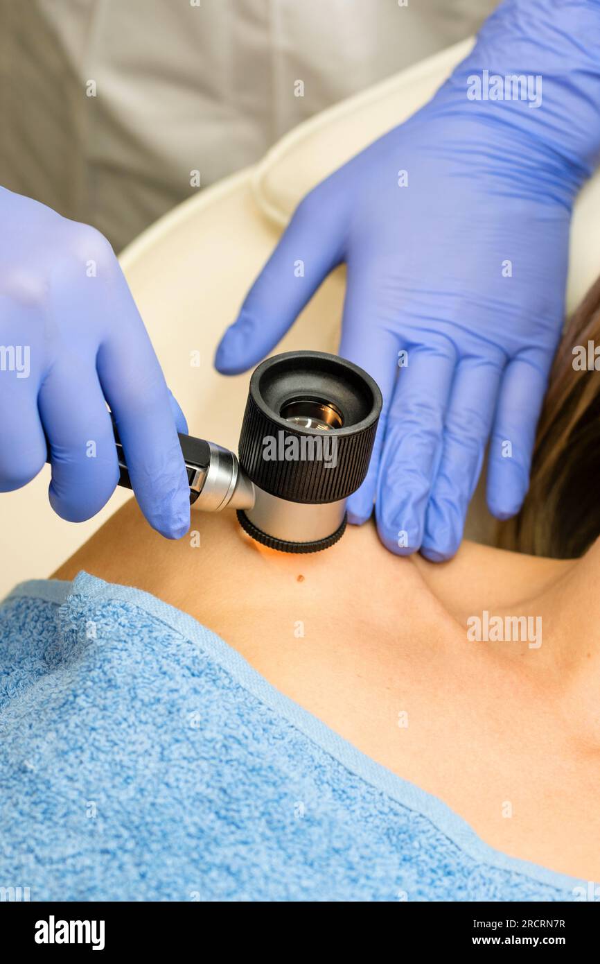 Doctor dermatologist examines moles and birthmarks of female patient ...