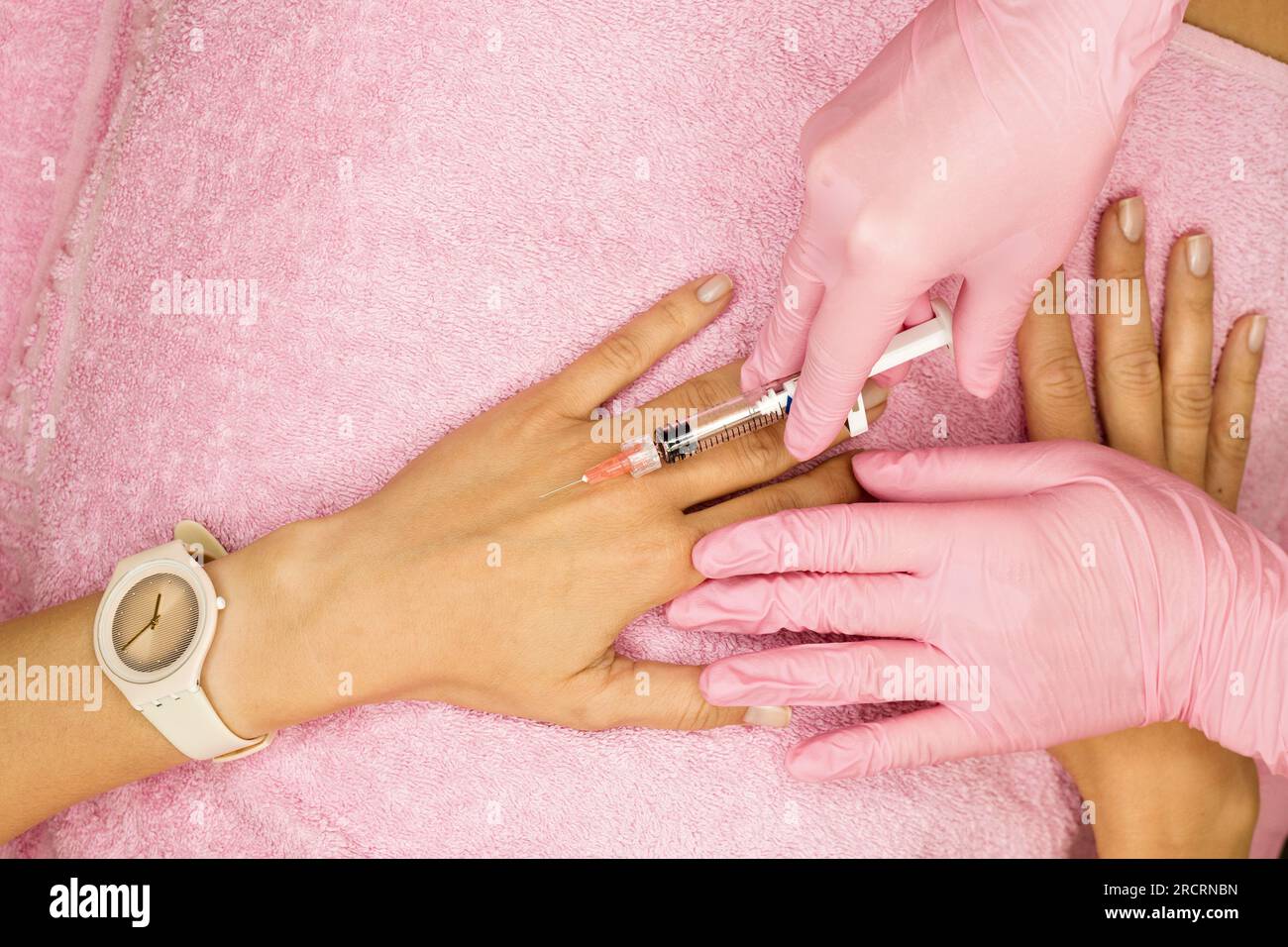 Hand skin rejuvenation mesotherapy injection for female patient. Anti ...