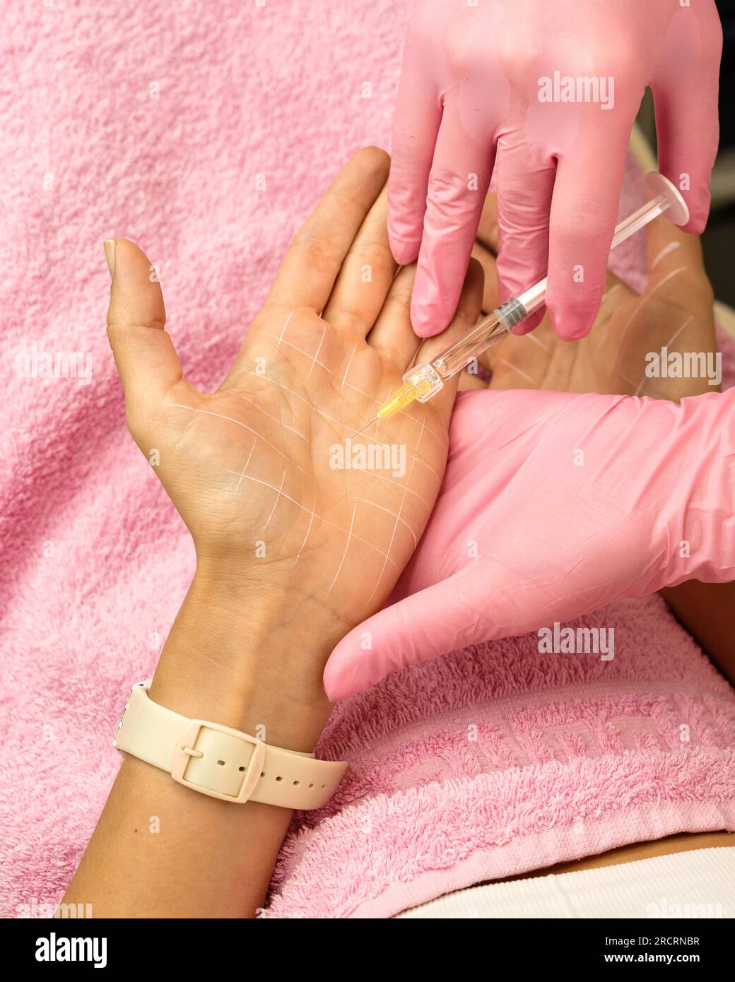 Esthetician makes injections of botulinum toxin in palm against ...