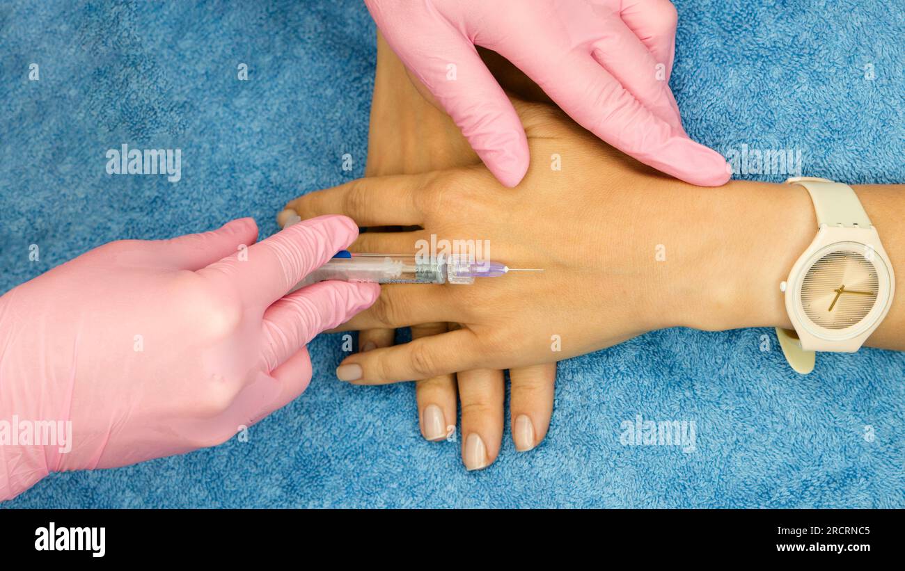Hand skin rejuvenation mesotherapy injection for female patient. Anti ...
