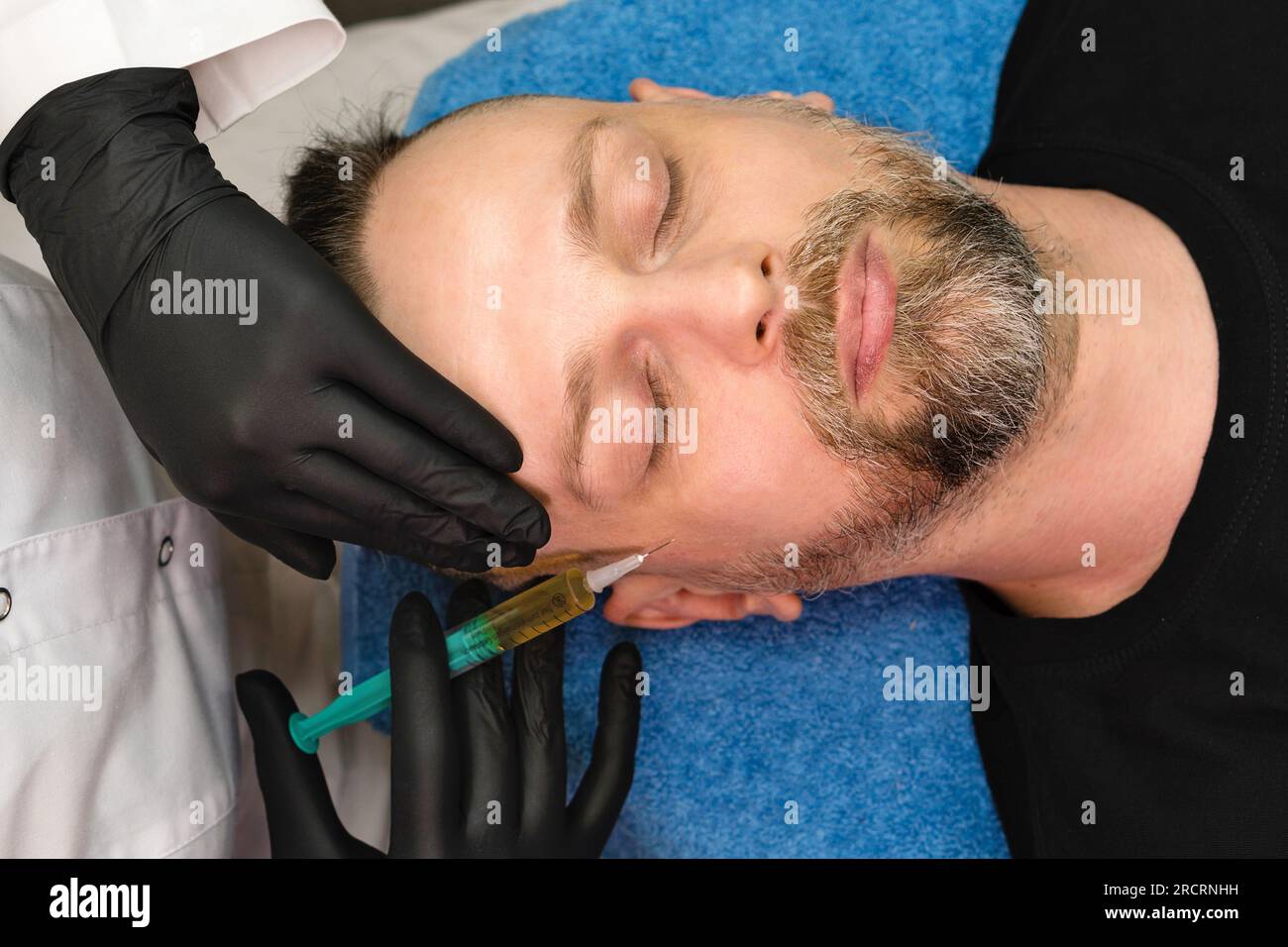 Сosmetologist uses thin needle to inject Platelet-Rich Plasma in skin ...