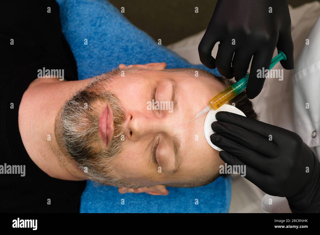 Сosmetologist uses thin needle to inject Platelet-Rich Plasma in skin ...