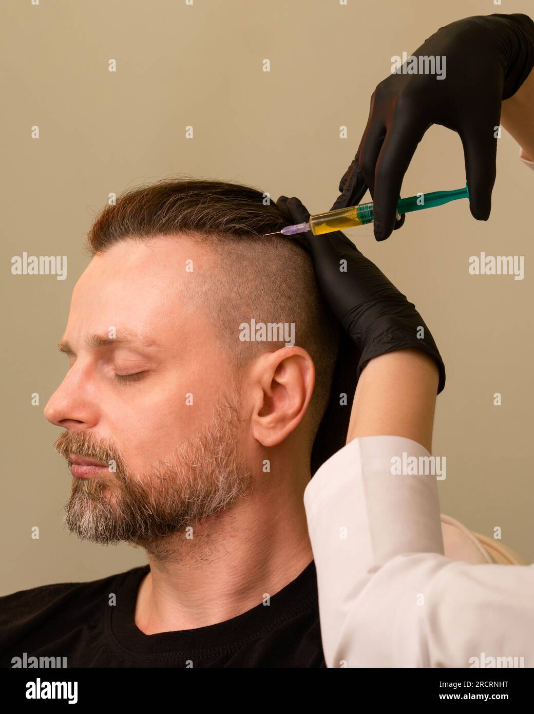 Esthetician uses thin needle to inject Platelet-Rich Plasma in scalp ...