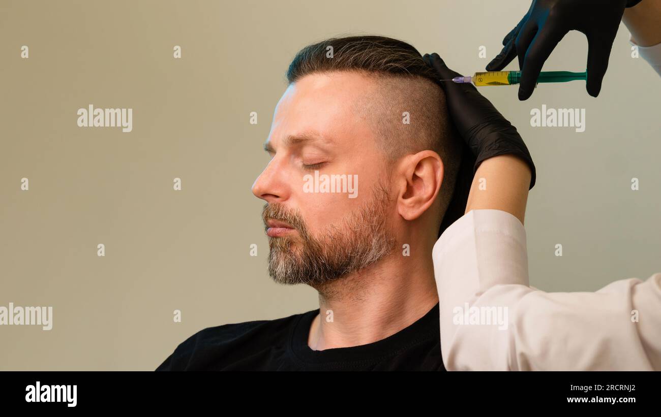 Сosmetologist uses thin needle to inject Platelet-Rich Plasma in scalp ...