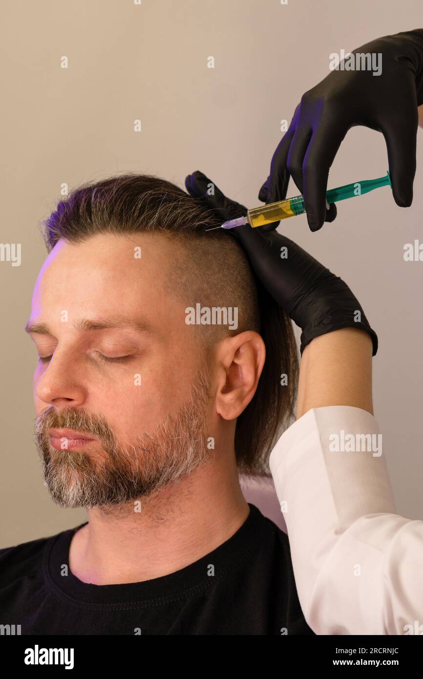 Esthetician uses thin needle to inject Platelet-Rich Plasma in scalp ...