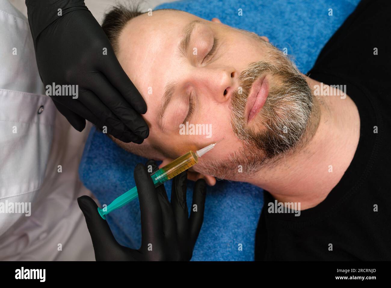 Esthetician uses thin needle to inject Platelet-Rich Plasma in skin ...