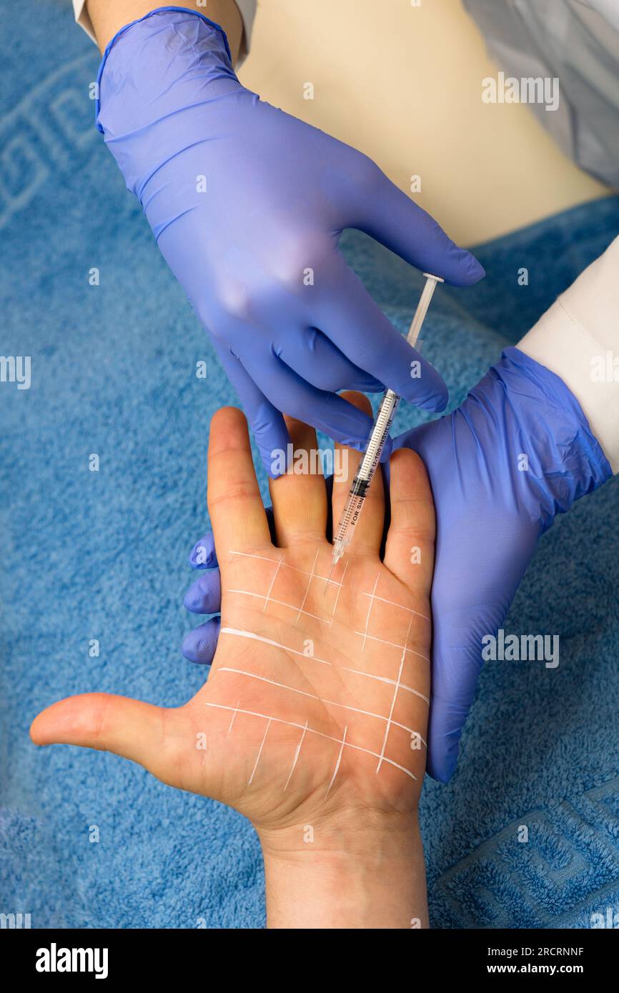 Beautician makes intramuscular injections of botulinum toxin in palm ...