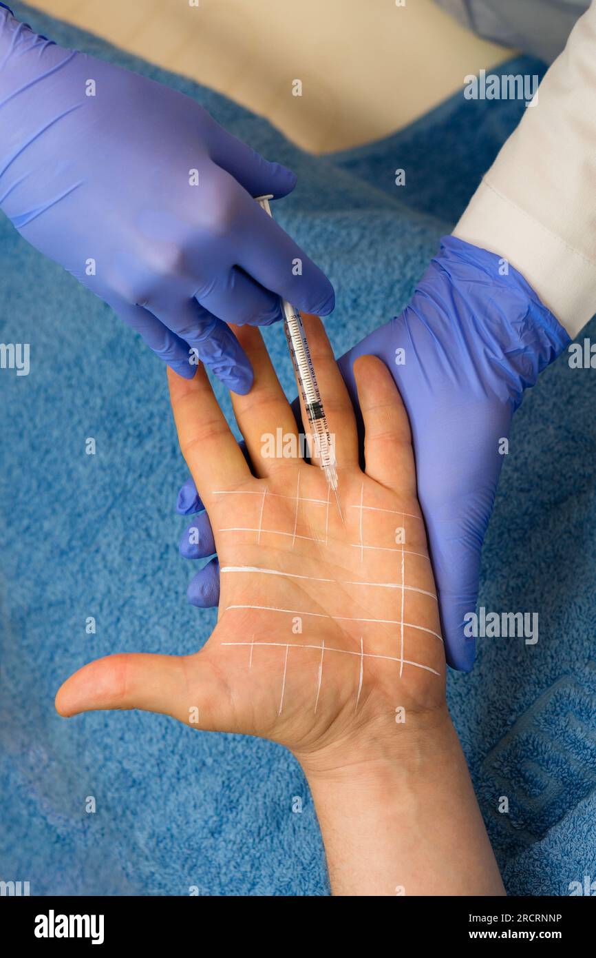 Esthetician makes injections of botulinum toxin in palm against ...