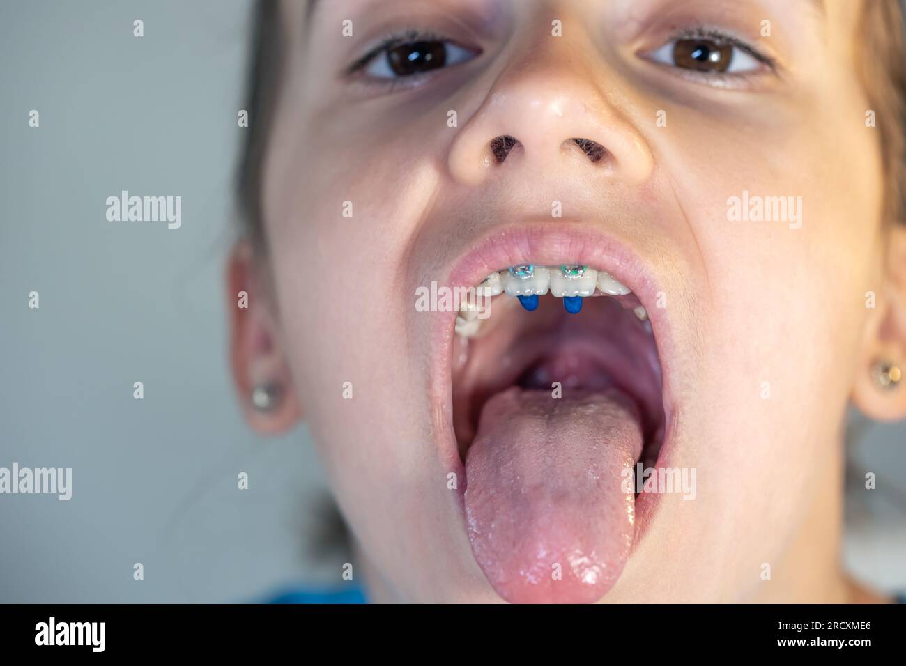 A child girl open her mouth and show her tounge Stock Photo - Alamy
