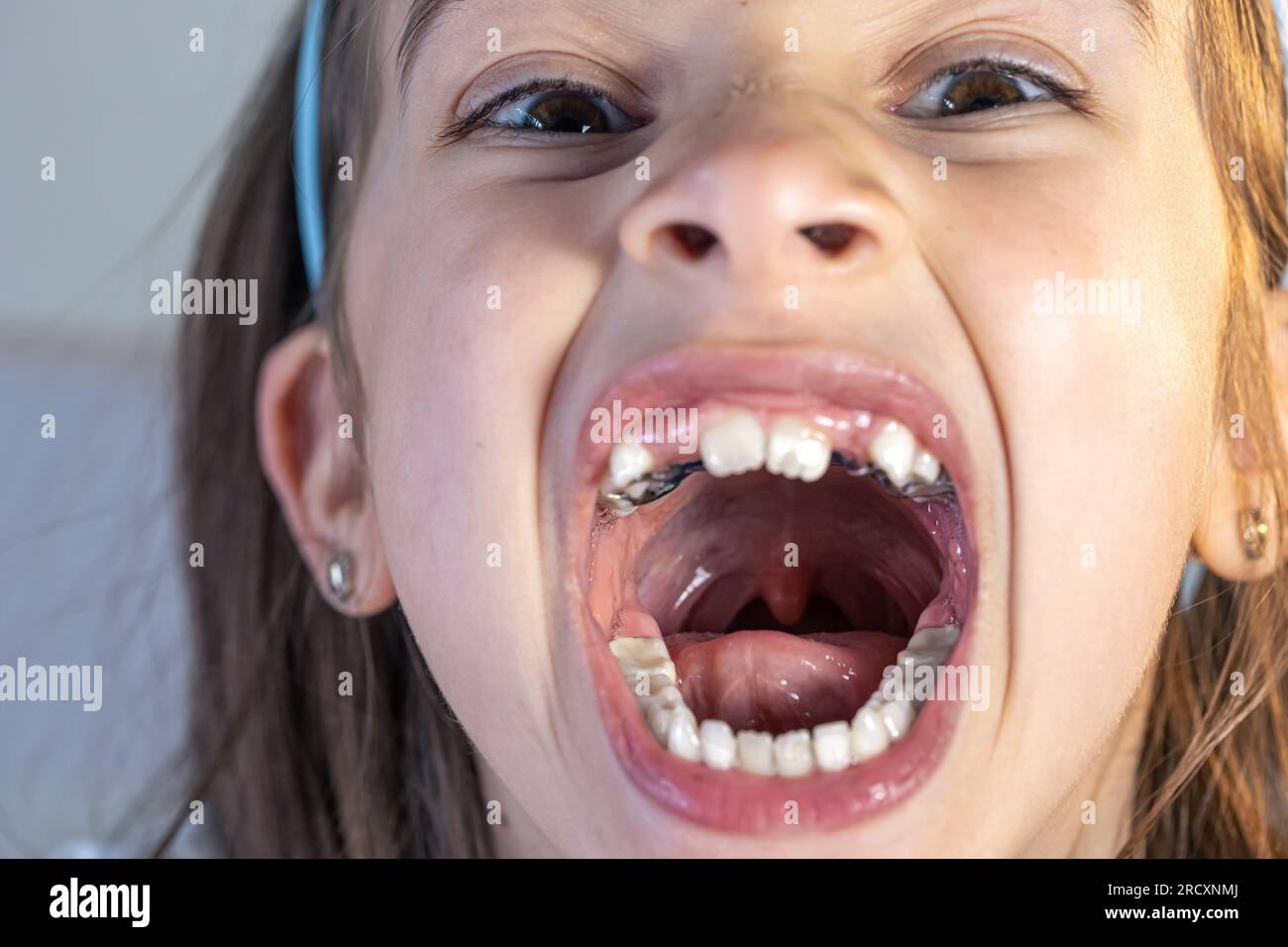 Child during orthodontist visit and oral cavity check-up Stock Photo ...