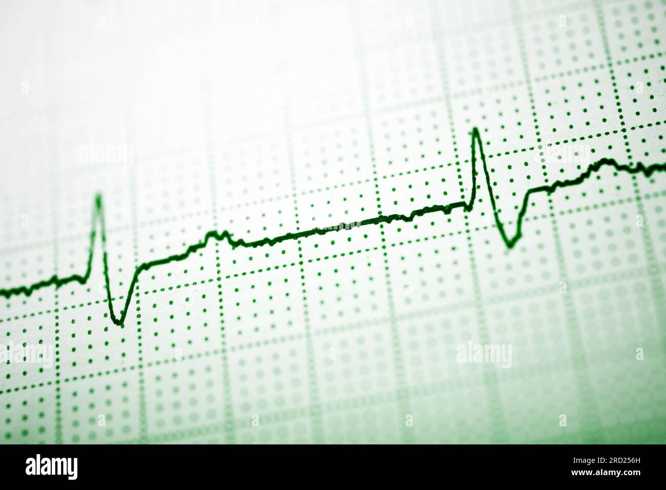 Electrocardiogram showing the pulse of the human heart Stock Photo - Alamy