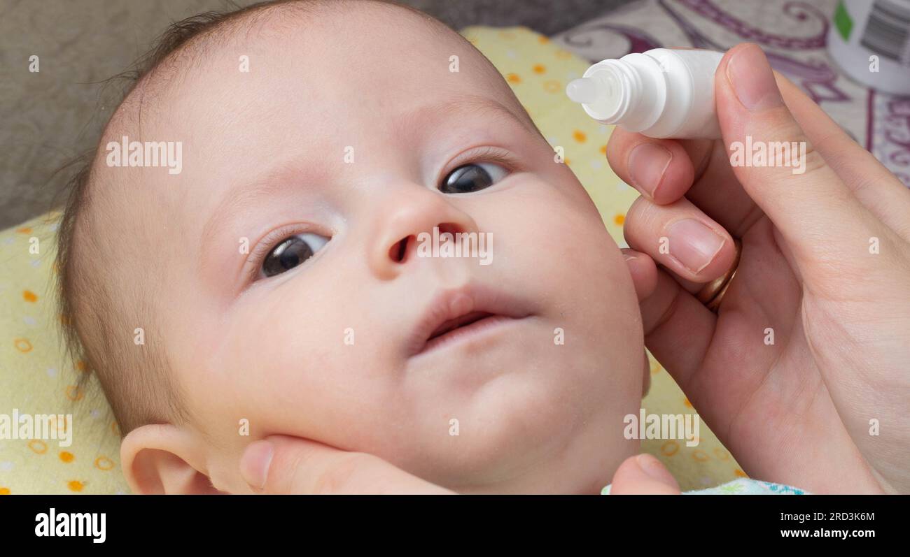 Instillation of medicinal drops in the eye of a child to treat ...