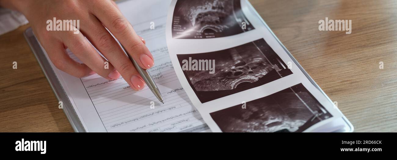 Close-up of doctor filling out medical paperwork Stock Photo - Alamy
