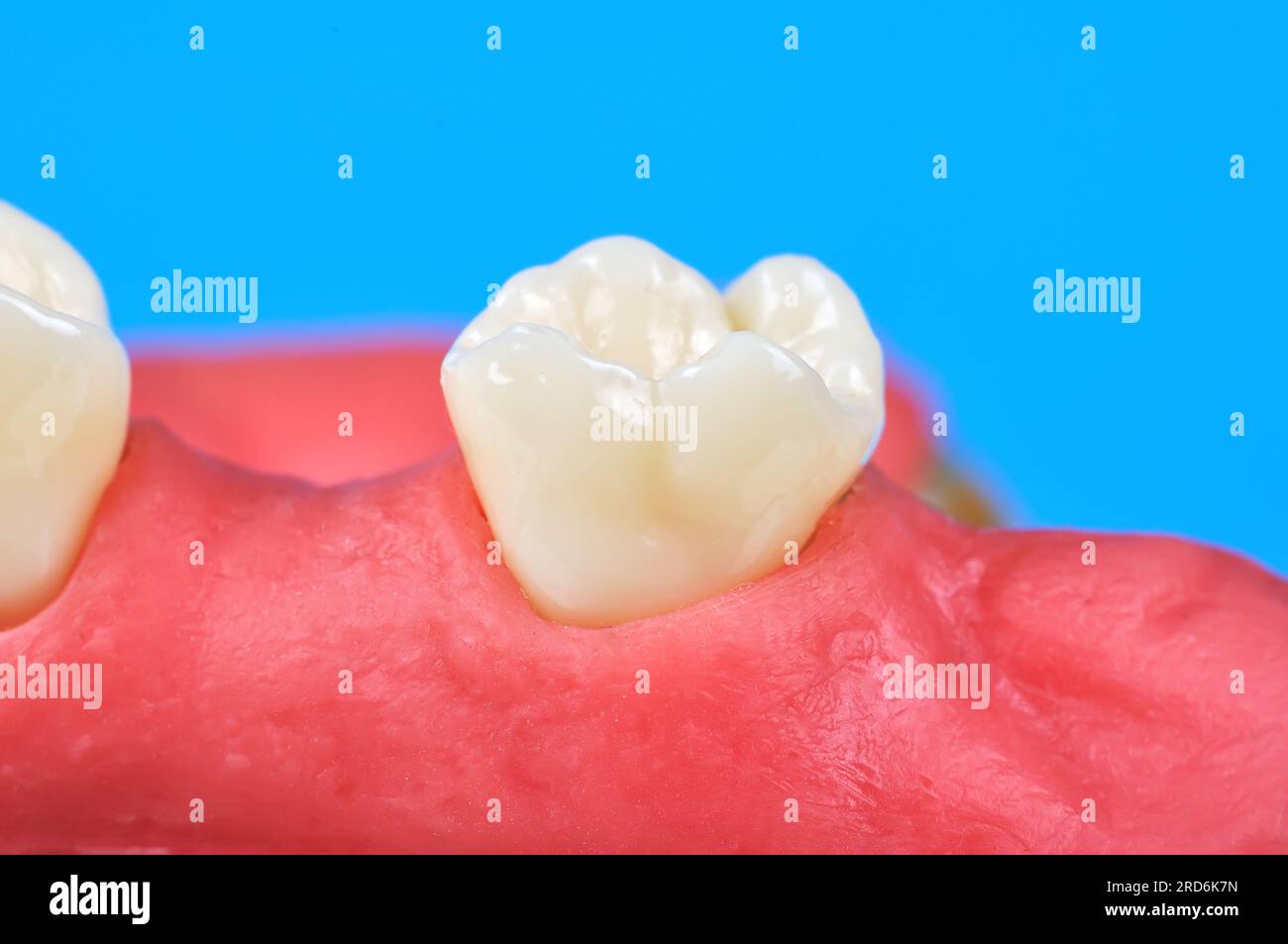 tooth in the gum extra close up Stock Photo - Alamy