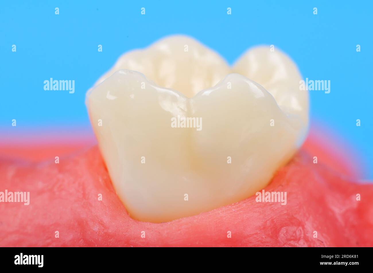 tooth in the gum extra close up Stock Photo - Alamy