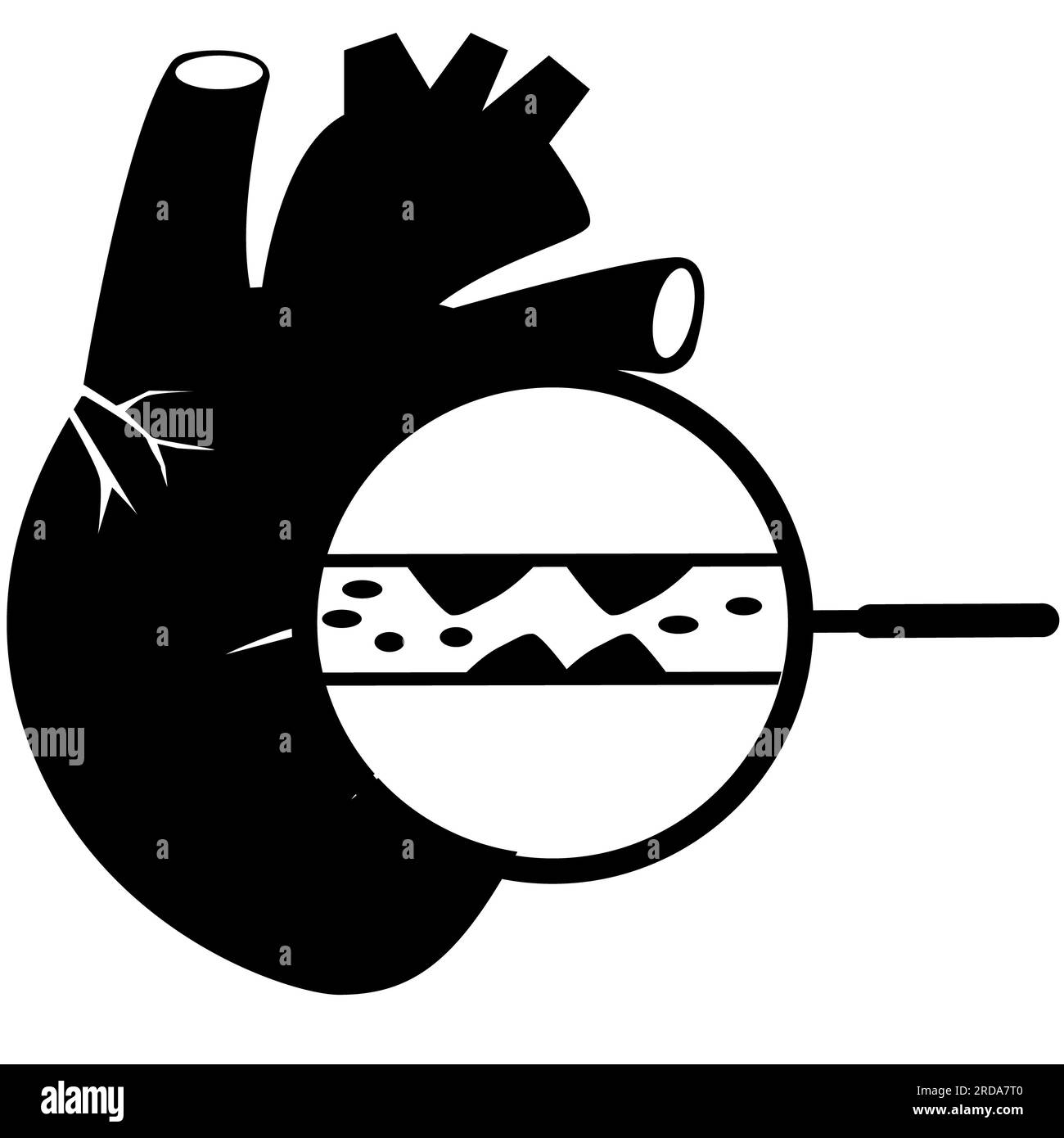 Cholesterol in human blood vessels and heart icon. High ldl sign ...