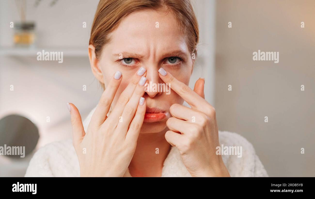 Skin problem bad cosmetics upset woman face skin Stock Photo - Alamy