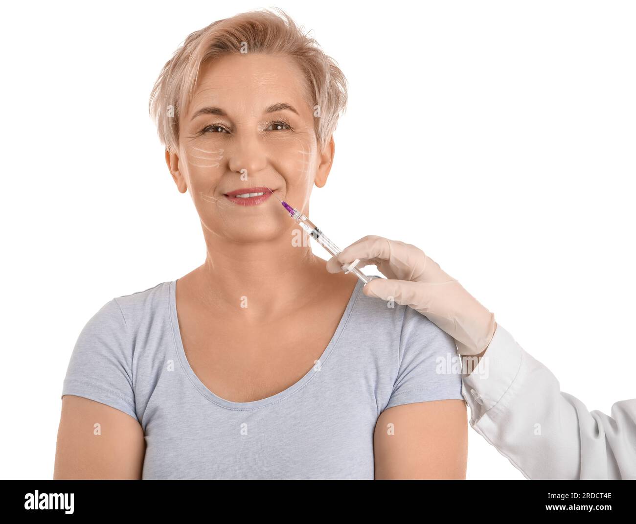 Mature Woman Receiving Lip Filler Injection On White Background