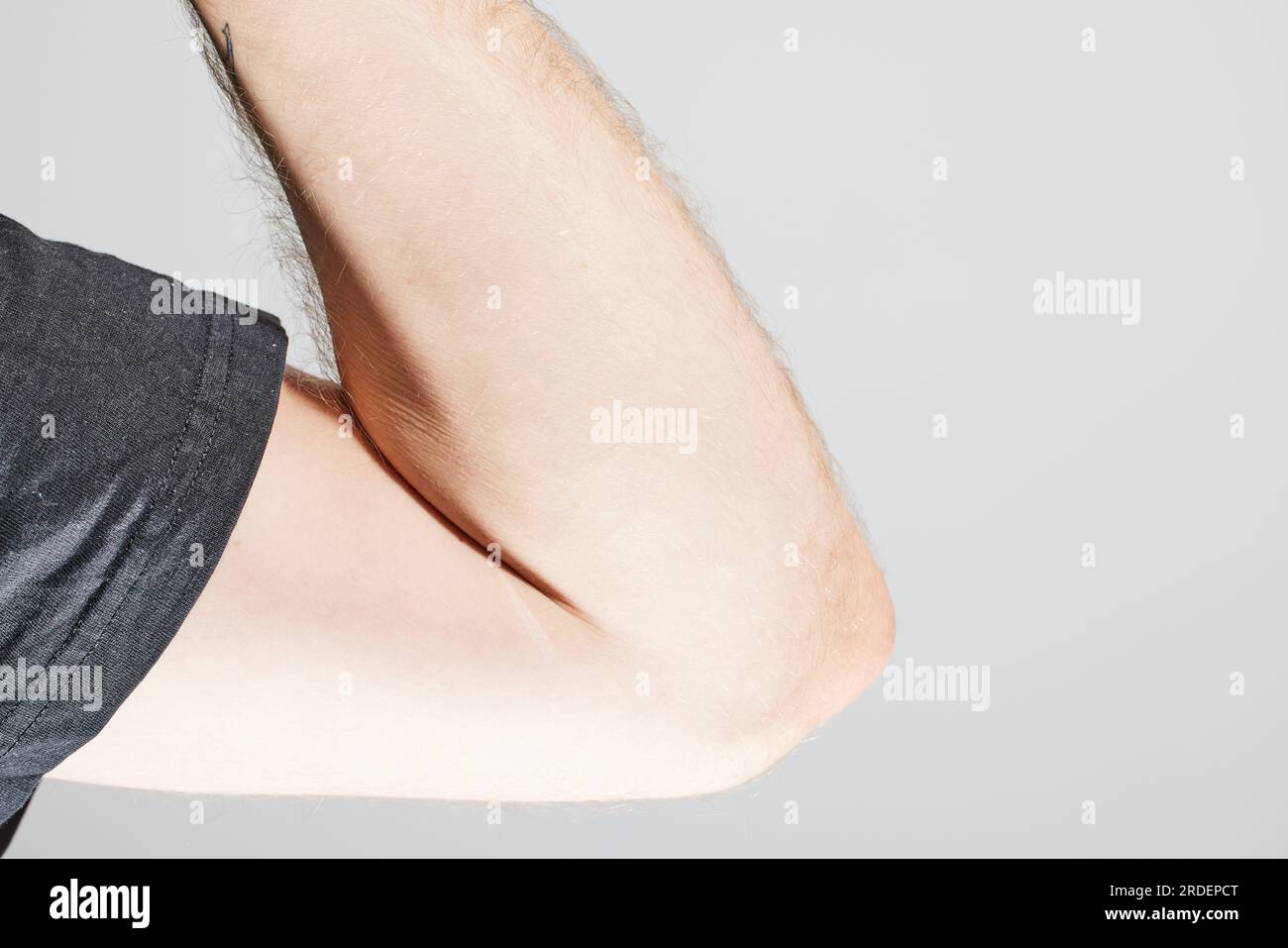 Elbow joint anatomy hi-res stock photography and images - Alamy