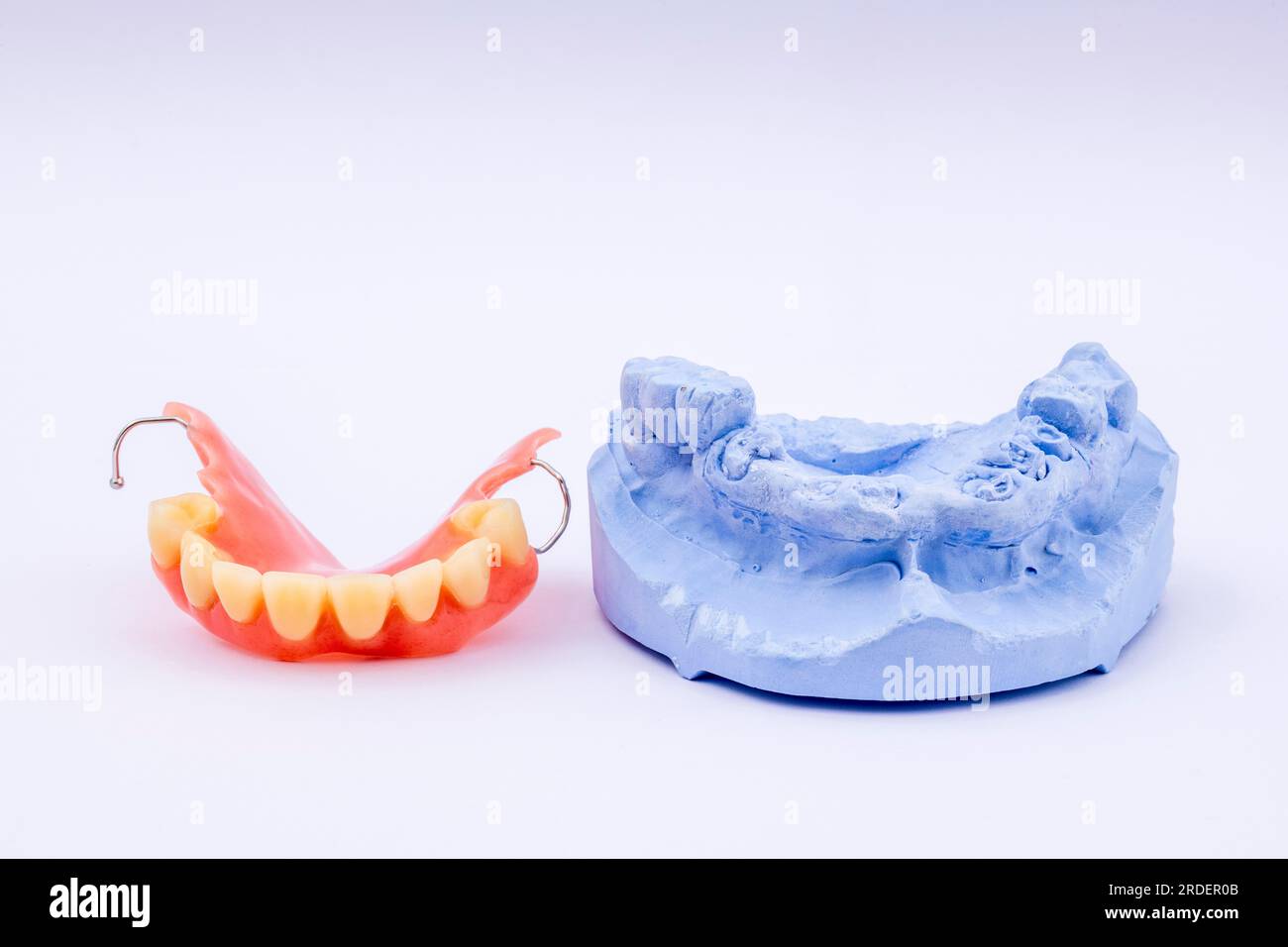 Removable denture of an upper jaw, denture, denture, dentist, dental ...