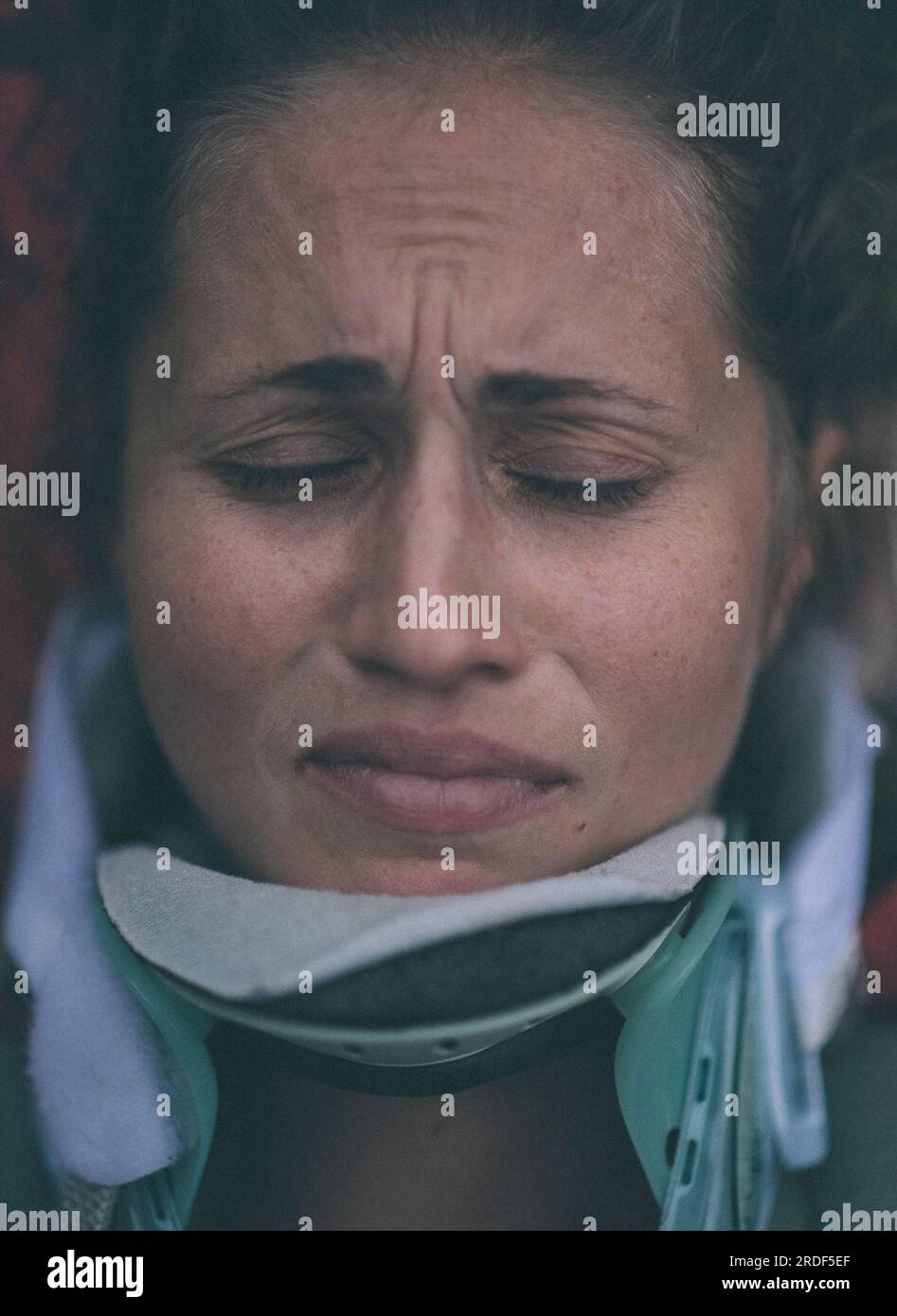 Hypermobile ehlers danlos syndrome hi-res stock photography and images ...