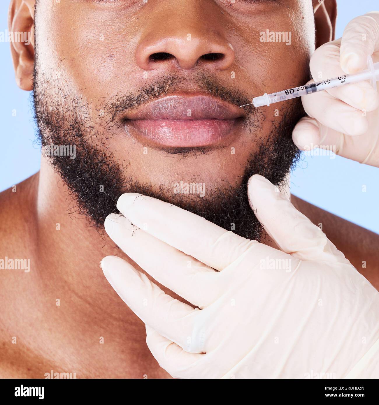 Man, plastic surgery and needle in studio for lips, filler and beauty ...