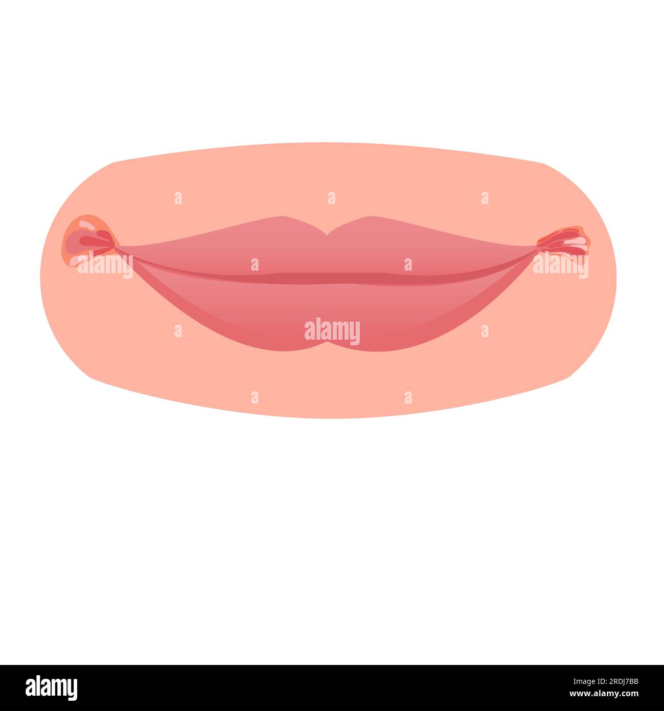 Angular cheilitis, illustration Stock Photo - Alamy Angular cheilitis, illustration Stock Photo - Alamy