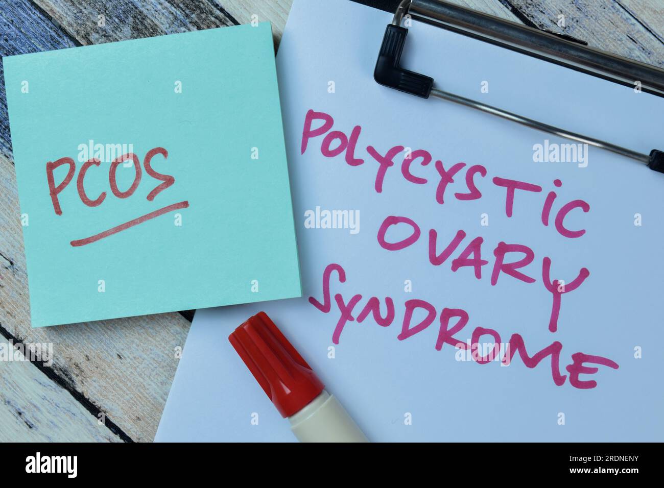 Symptoms polycystic ovary syndrome hi-res stock photography and images ...