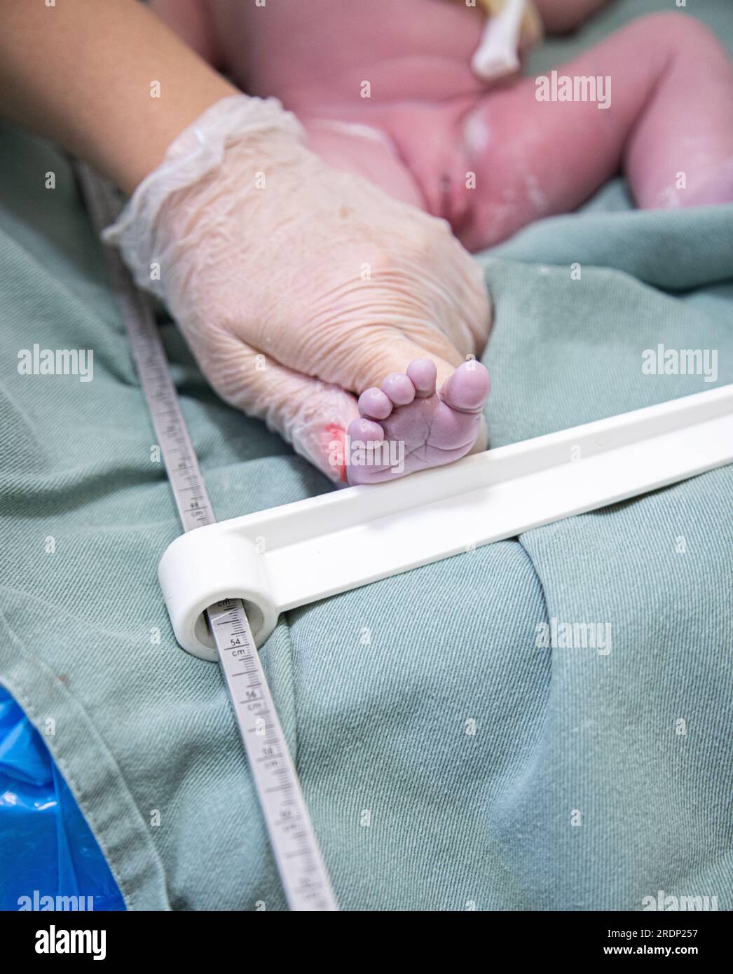 doctor performing measurement procedure on newborn Stock Photo - Alamy