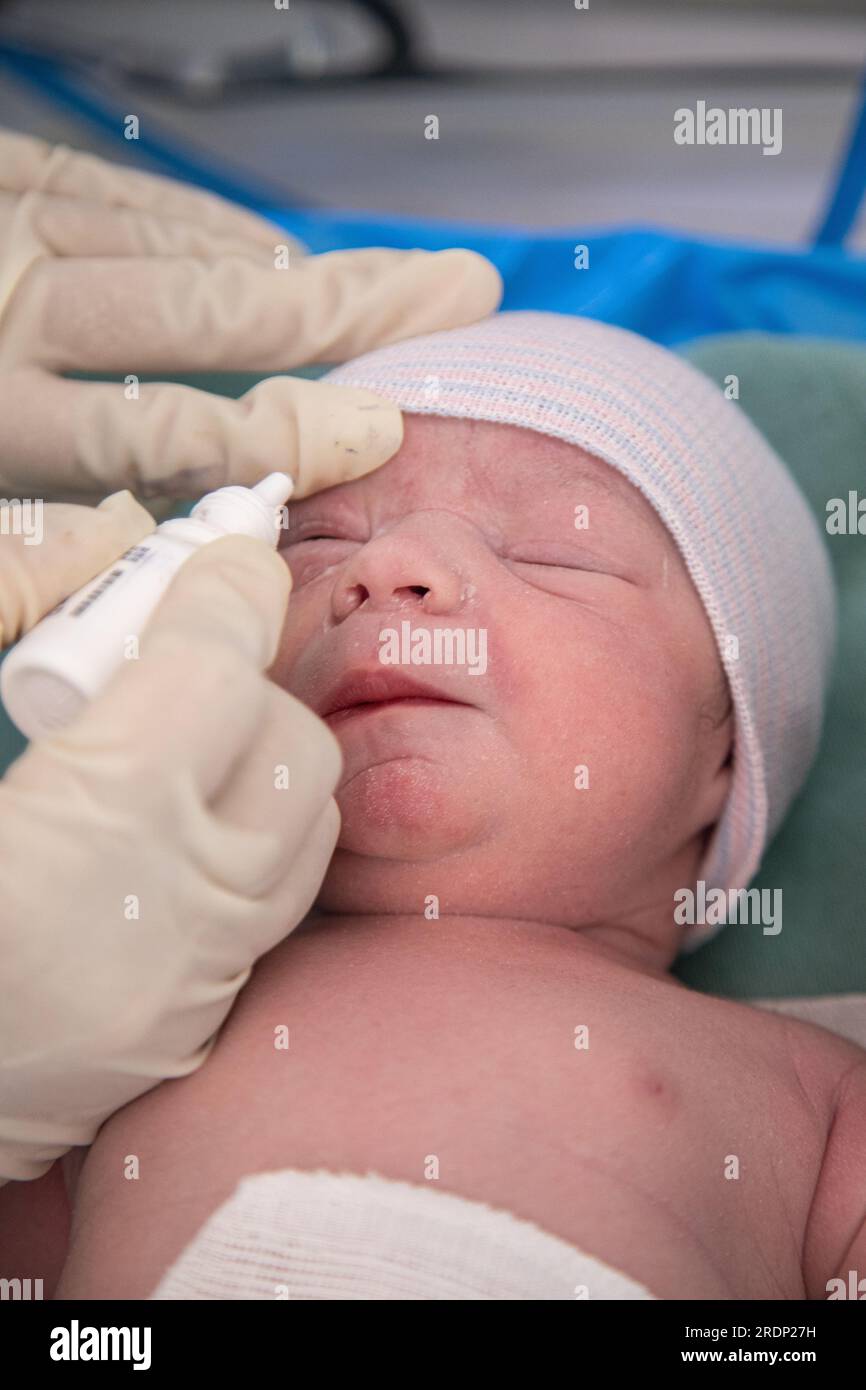 Child eye drops hi-res stock photography and images - Alamy