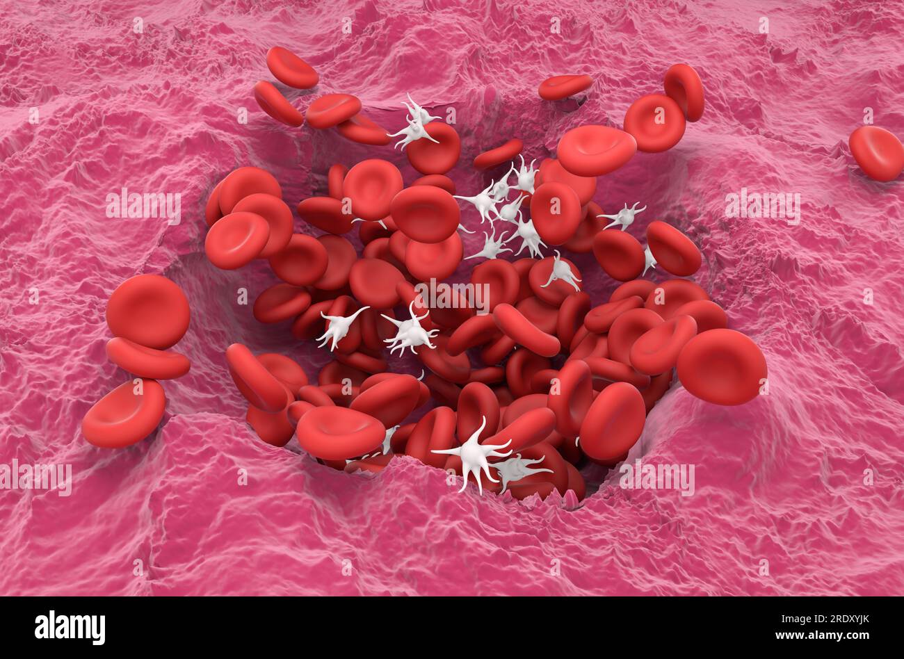Red blood cells (RBC) and platelets in the healing wound - isometric ...