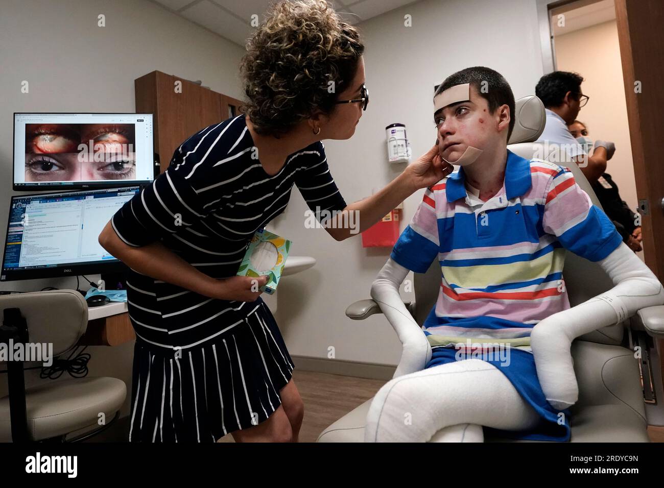 Photos of Antonio Vento Carvajal's eyes, left, photographed before and ...