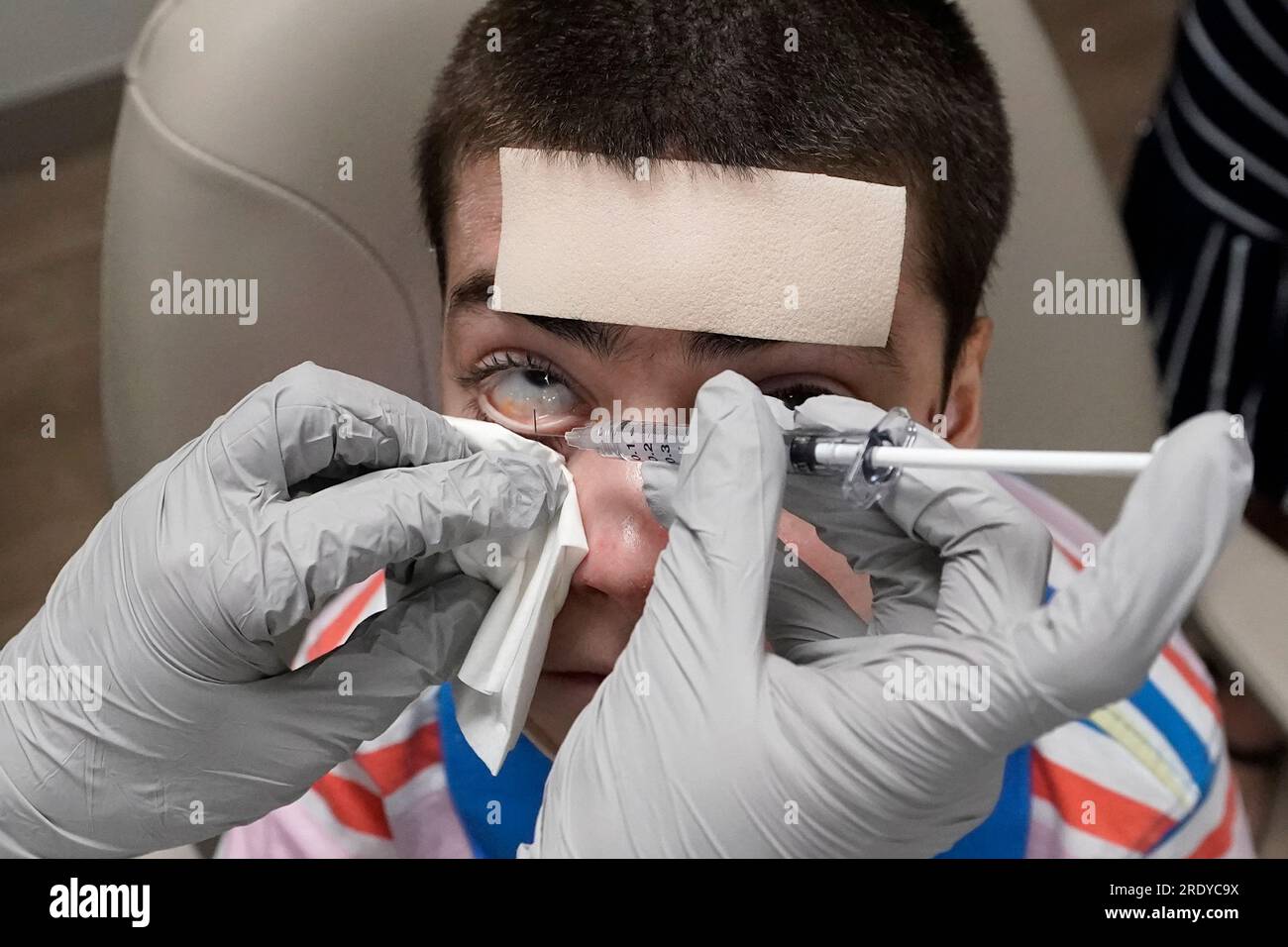 Dr. Alfonso Sabater, uses a syringe to apply gene therapy eyedrops to ...