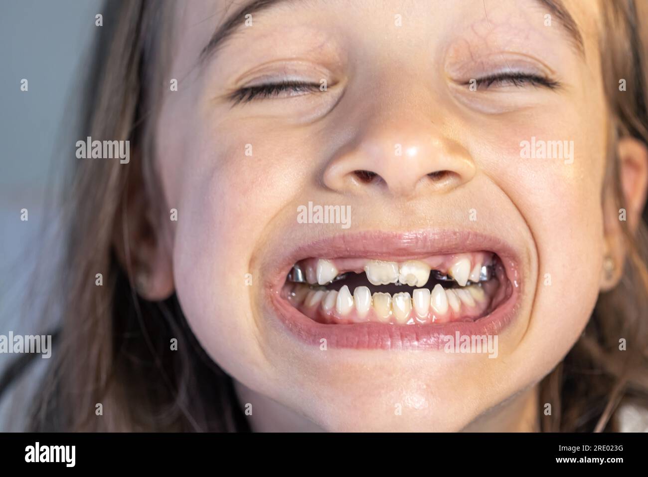 Child during orthodontist visit and oral cavity check-up Stock Photo ...