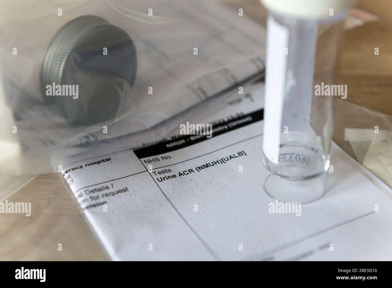 A sample container and a medical form for a Urine ACR test Stock Photo ...