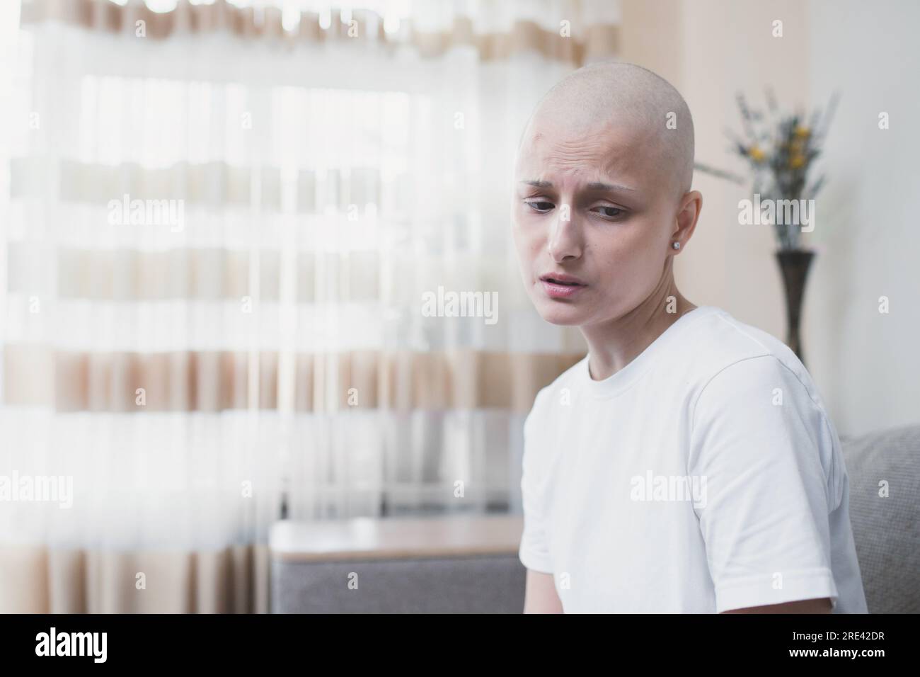Sad tired bald young woman with oncology in home room after ...