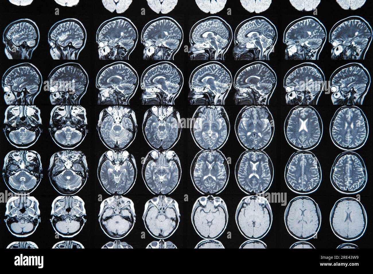 Layered image with magnetic resonance imaging mri of the human head ...
