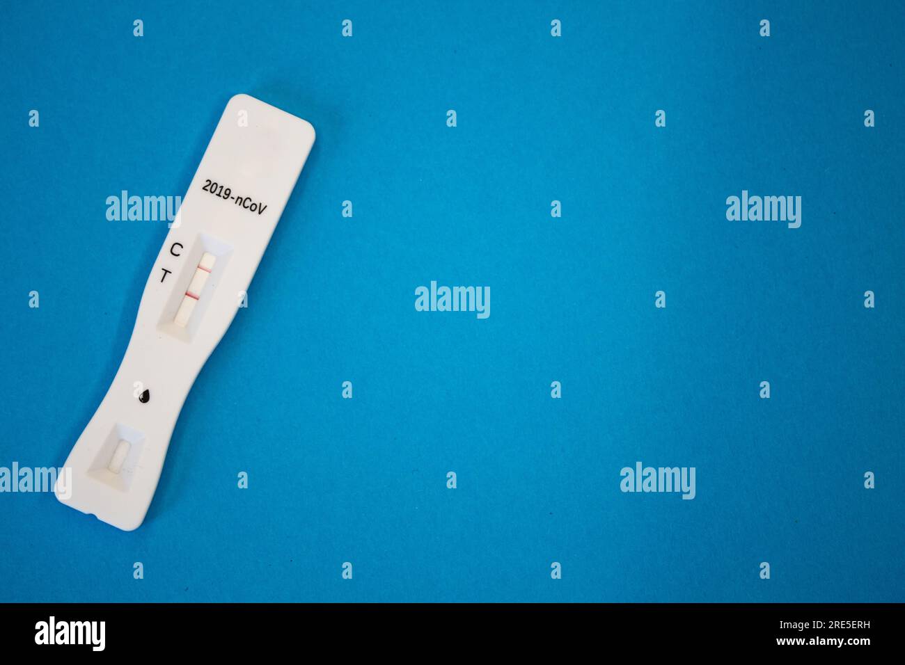 Covid positive test detail. Positive result of the SARS-Cov-2 ...