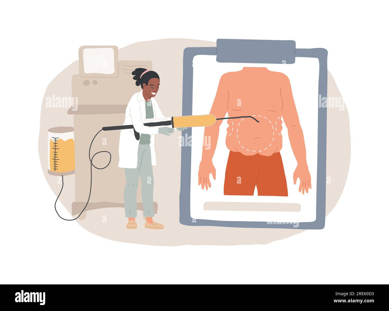 Liposuction isolated concept vector illustration. Lipo procedure ...