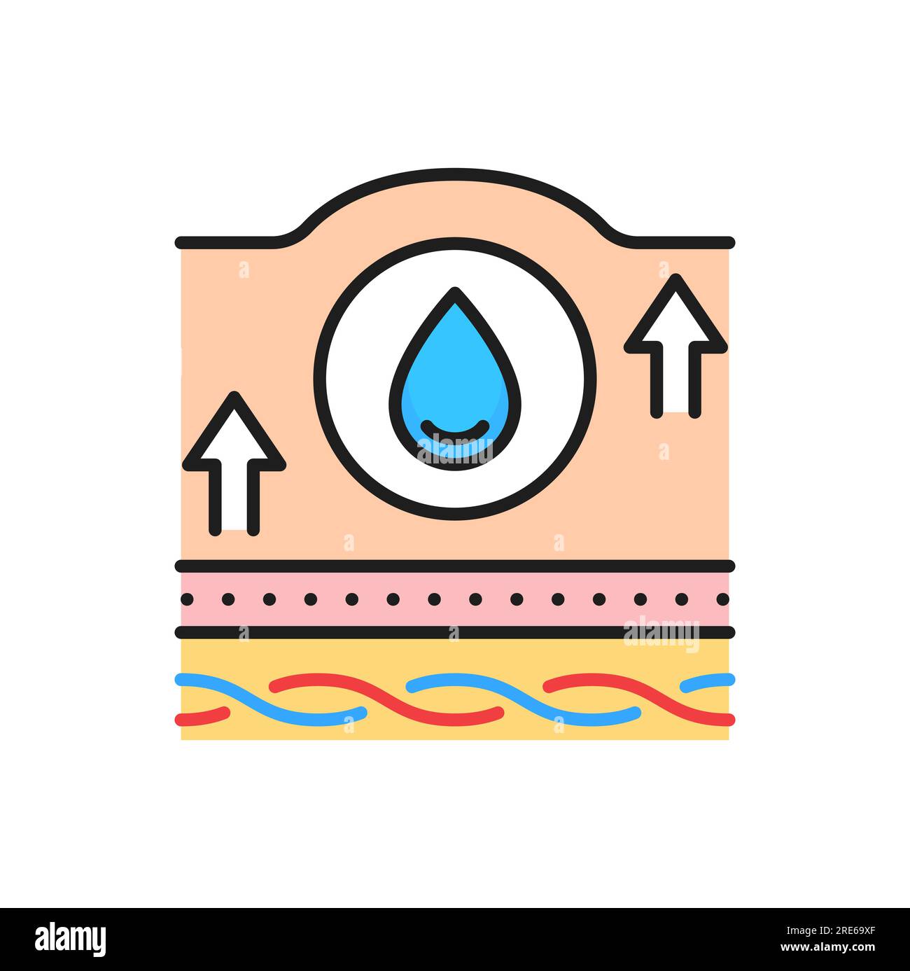 Varicose vein closed damaged valve, edema and swelling process, skin ...