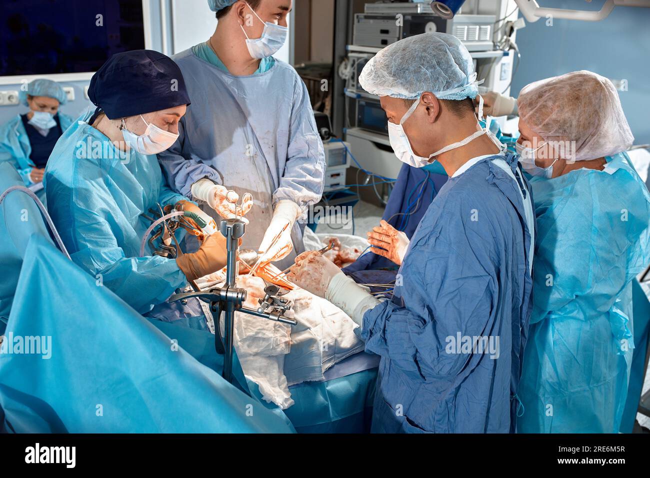 Top view of surgeons team during complex surgical operation in a bright ...