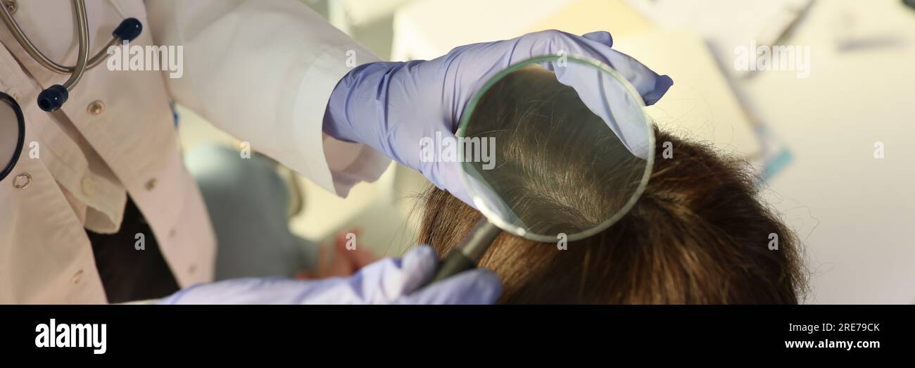 Trichoscopy procedure hi-res stock photography and images - Alamy