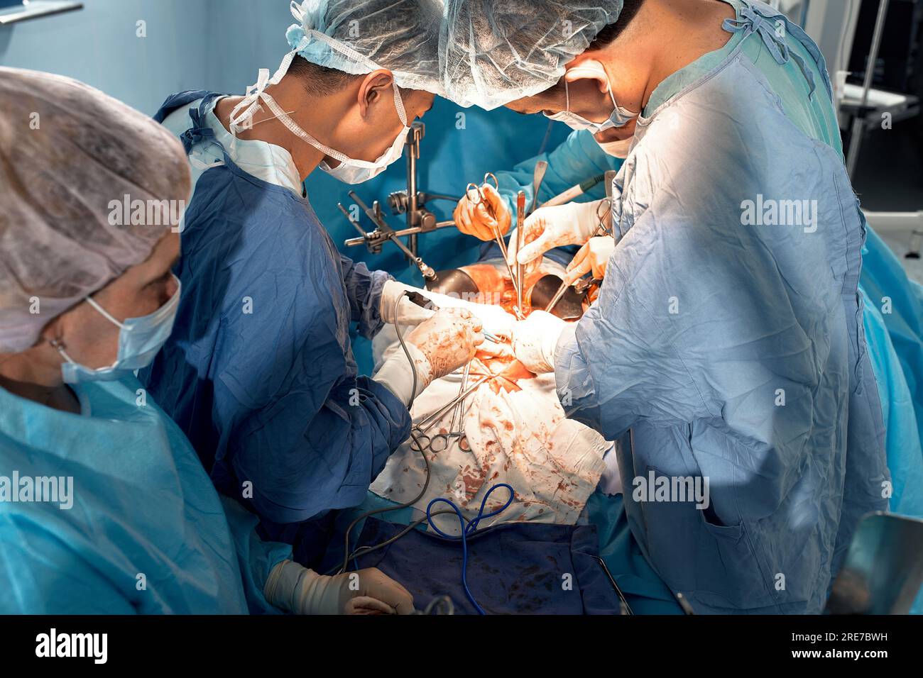 Top view of surgeons team during complex surgical operation in a bright ...